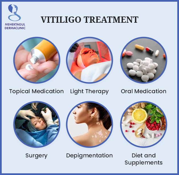 Vitiligo Treatment in Delhi | Mehektagul Dermaclinic