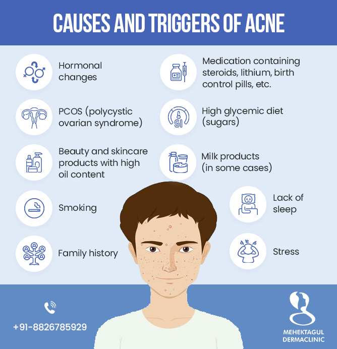 Acne Treatment in Delhi | Acne Treatment Cost in Delhi